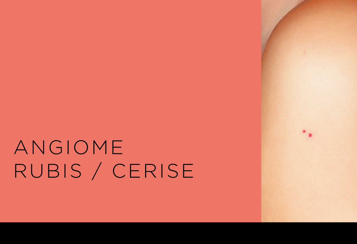 Bouton de sang sur la peau: Angiome rubis / cerise – Clinique médico ...