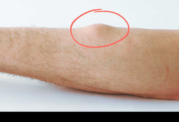 Quel est le prix d'un dermatologue privé au Québec? – Clinique médico ...