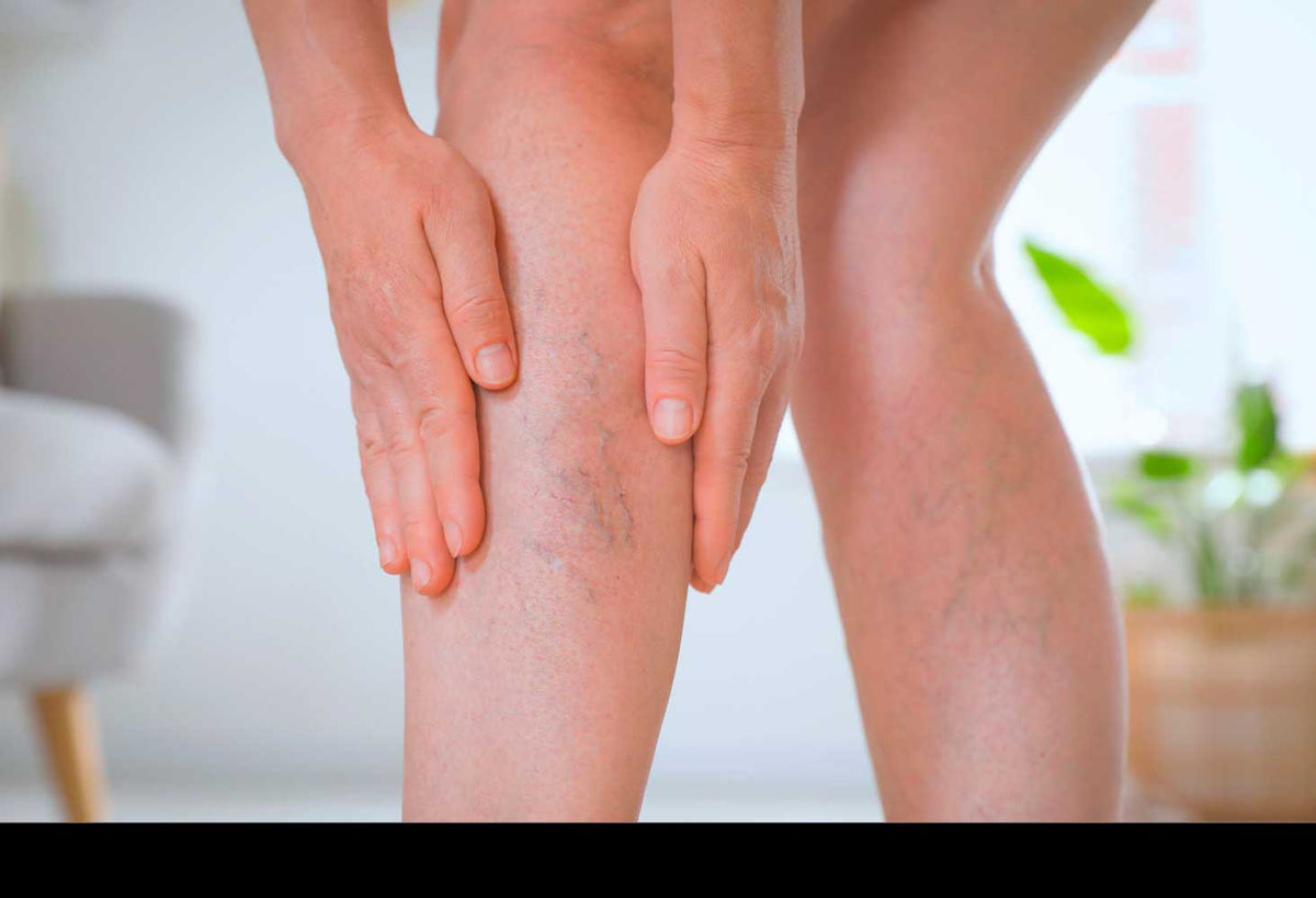 Traitement pour insuffisance veineuse des jambes – Clinique médico ...