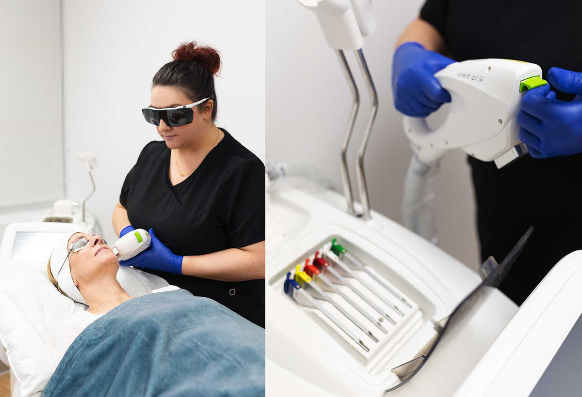 Traitement IPL (Lumière pulsée) – Clinique médico-esthétique de Québec